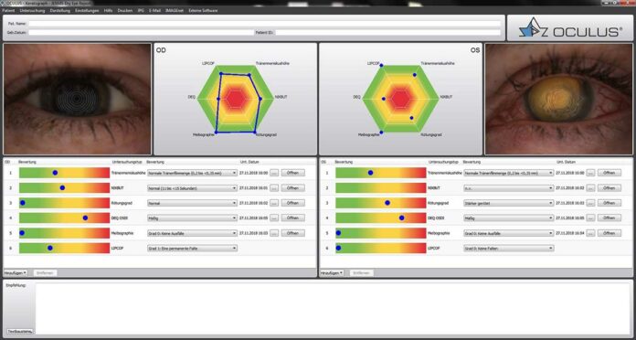 Kosmetische Versorgung mit einer prothetischen Iriskontaktlinse ...