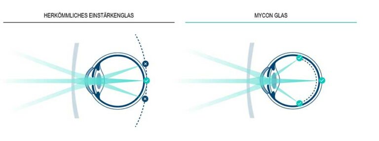 Rodenstock präsentiert die neuen Brillengläser MyCon - optikum ...